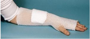 Tubular Elastic Dressings Retainer Net - Singles ...